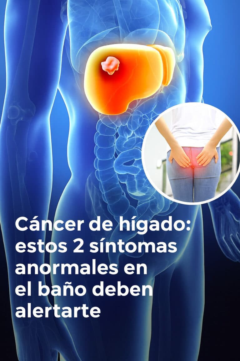 Síntomas del cáncer de hígado tras muerte de Thierry Ardisson ...